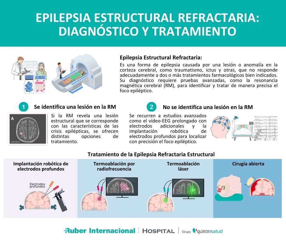 Epilepsia Refractaria : Diagnóstico y tratamiento avanzado